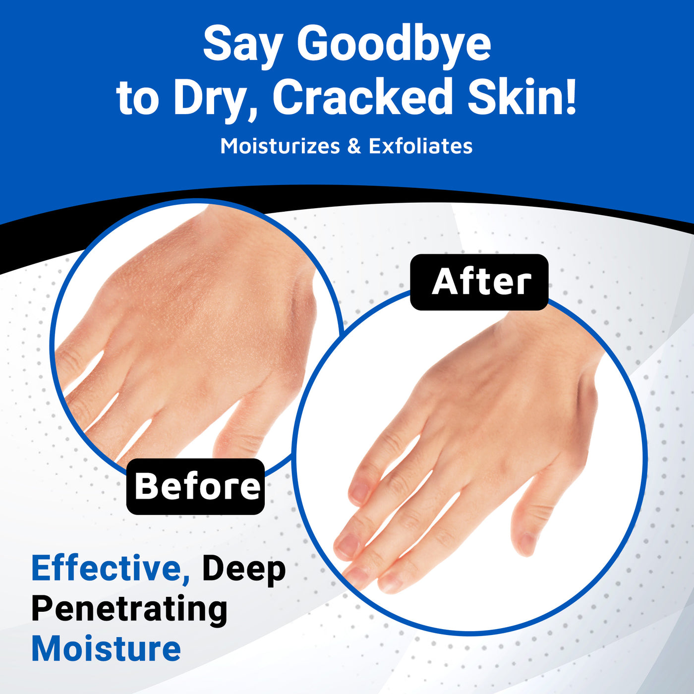 Alpha Hydroxy Lotion | 10% Urea/10% Lactic Acid | Dermal Therapy-16oz
